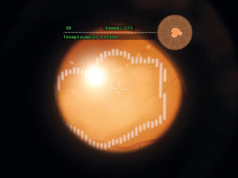 Eyesi Direct Ophthalmoscope